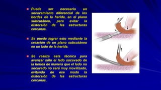 INCISION QUIRURGICA EN CARA Y CUELLO | PPTX