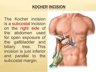 surgical Incisions - sadeghi mazloumi | PPT