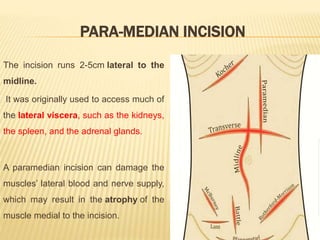 surgical Incisions - sadeghi mazloumi | PPT