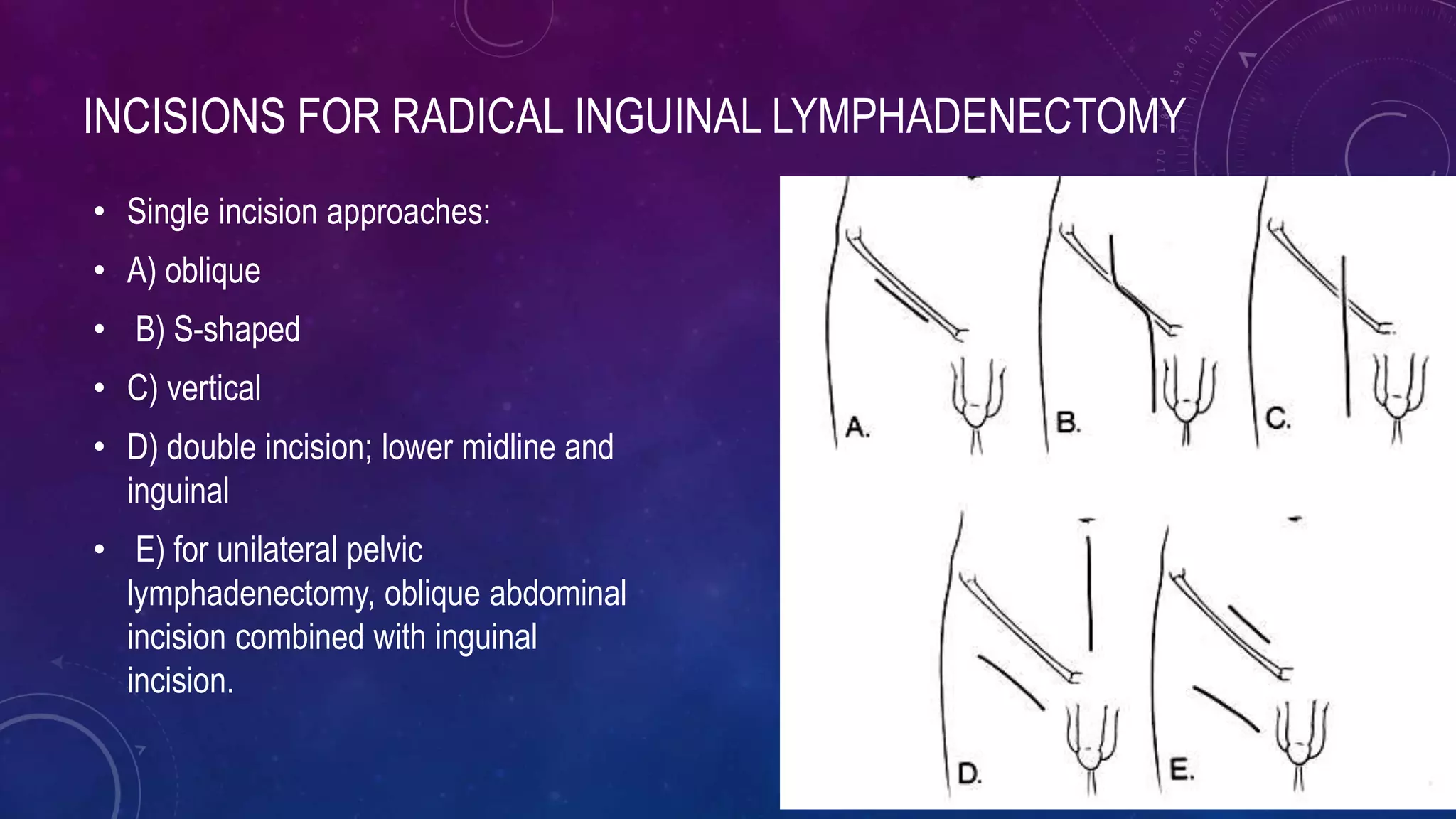 Incisions and position in general surgery by dr chandrakant sabale ...
