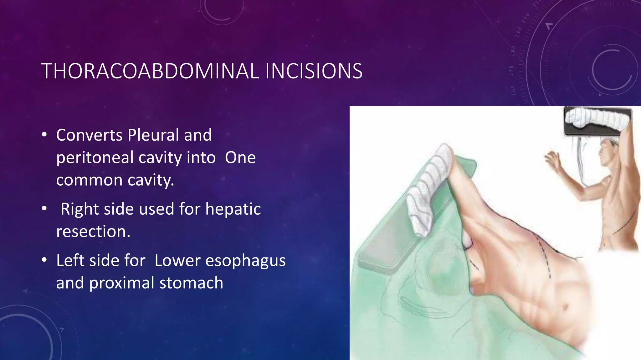 Incisions and position in general surgery by dr chandrakant sabale ...