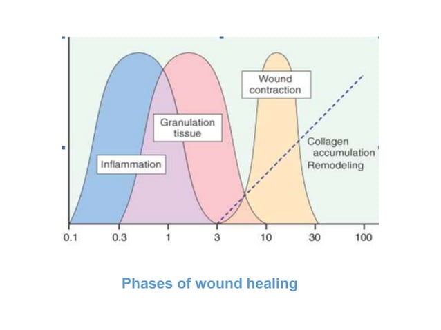 Incisions and wound healing 02