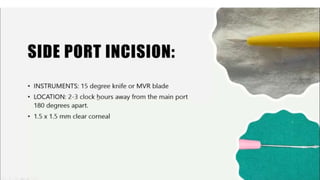 INCISIONS IN CATARACT SURGERY.pptx