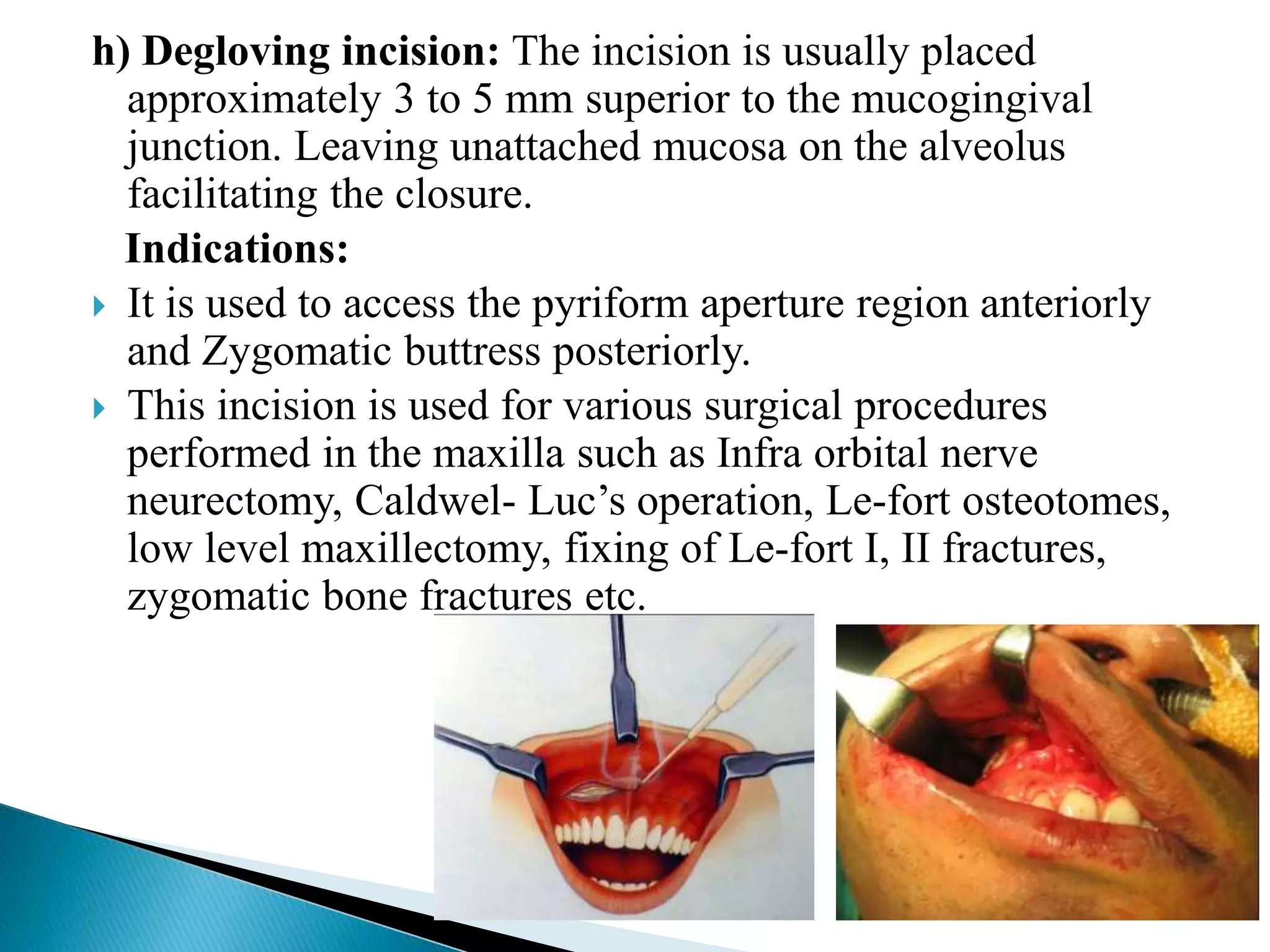 Incisions in head and neck region | PPTX