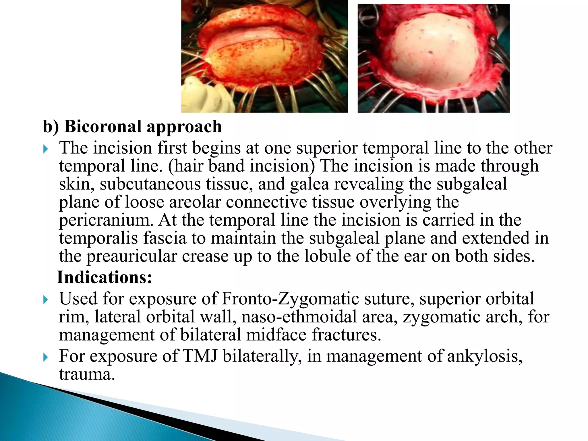 Incisions in head and neck region | PPTX