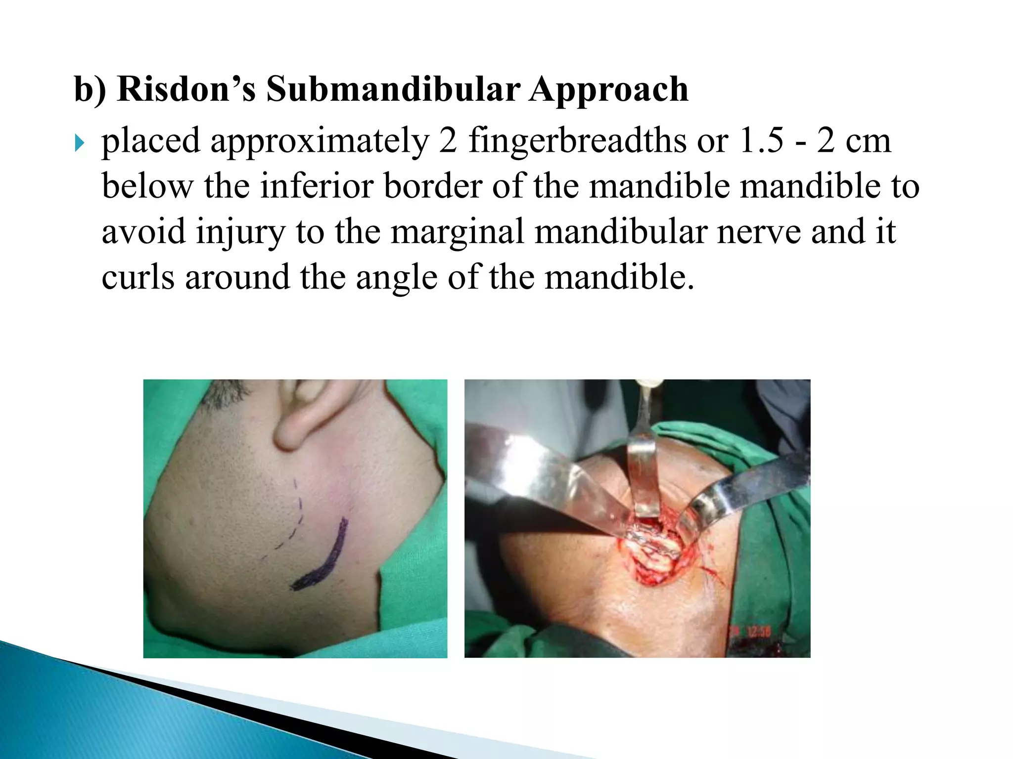 Incisions in head and neck region | PPTX