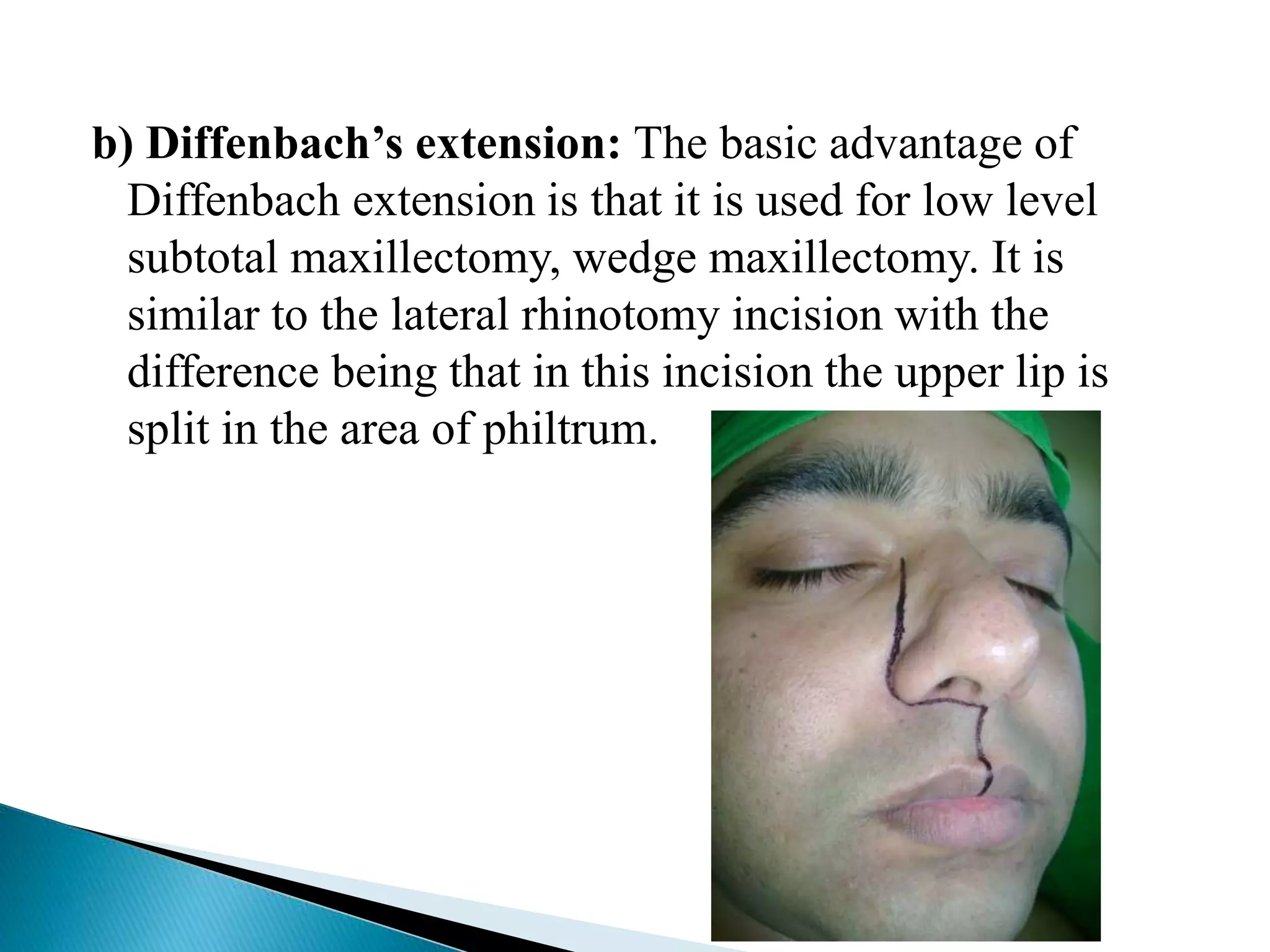 Incisions in head and neck region | PPTX