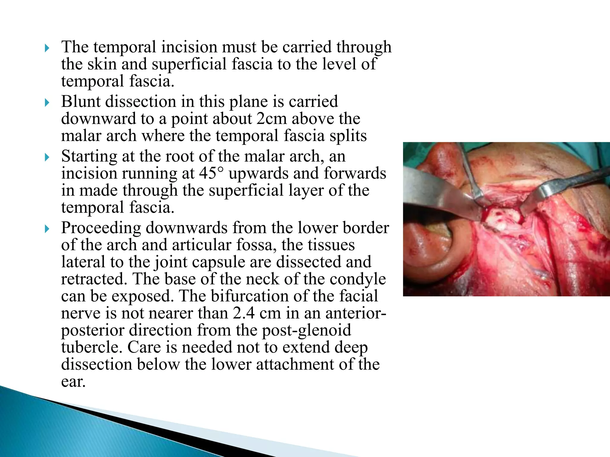 Incisions in head and neck region | PPTX