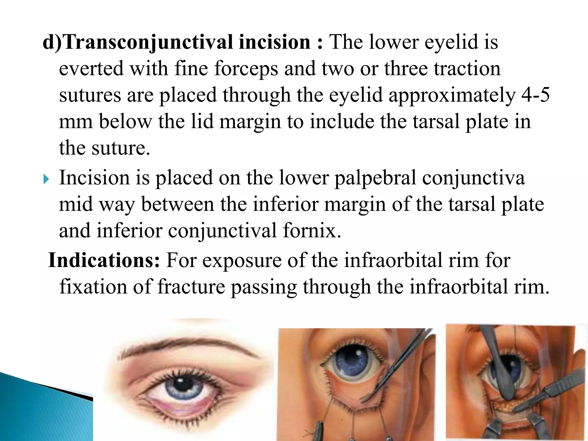 Incisions in head and neck region | PPTX