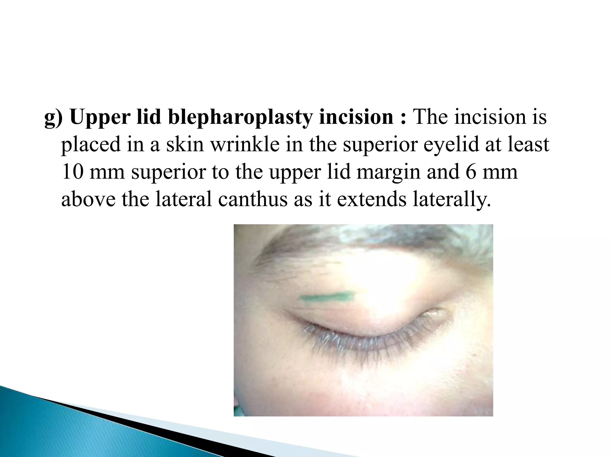 Incisions in head and neck region | PPTX