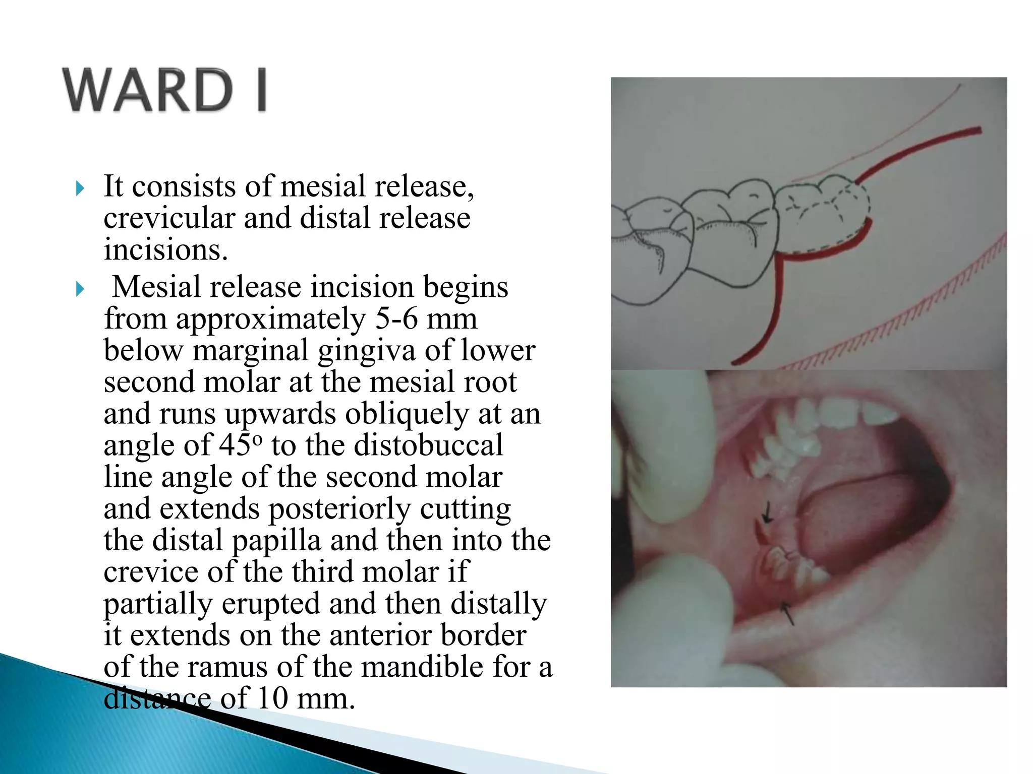 Incisions in head and neck region | PPTX