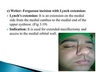 Incisions in head and neck region | PPTX