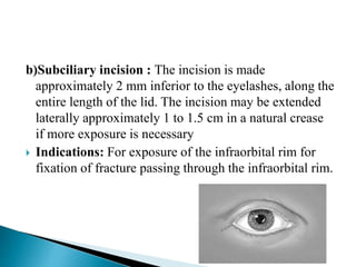 Incisions in head and neck region | PPTX