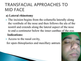 Incisions in head and neck region | PPT