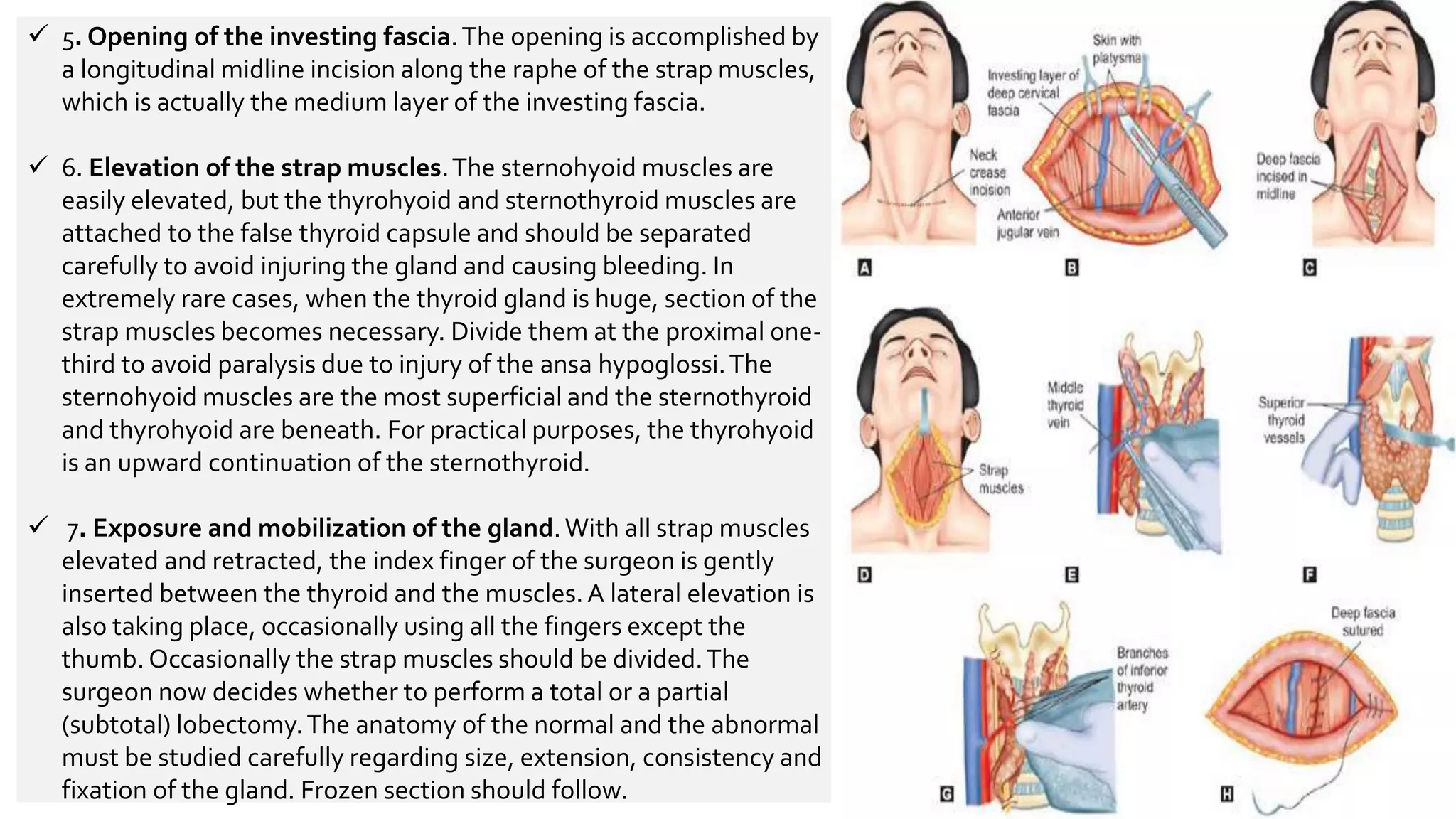 Incisions in the neck, thyroidectomy, parathyroidectomy | PPTX
