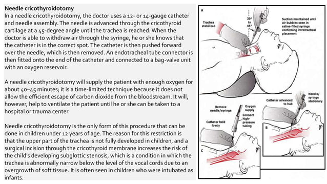Incisions in the neck, thyroidectomy, parathyroidectomy | PPTX