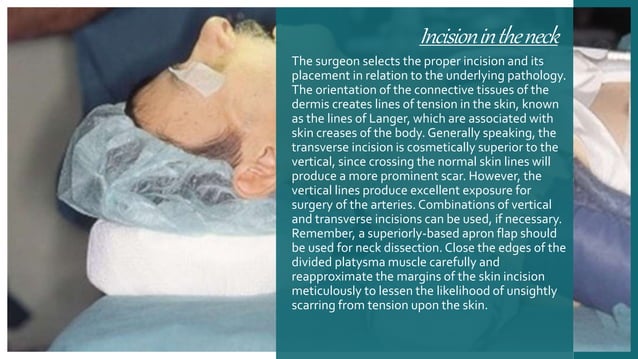 Incisions in the neck, thyroidectomy, parathyroidectomy | PPTX