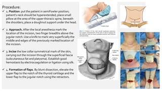Incisions in the neck, thyroidectomy, parathyroidectomy | PPTX