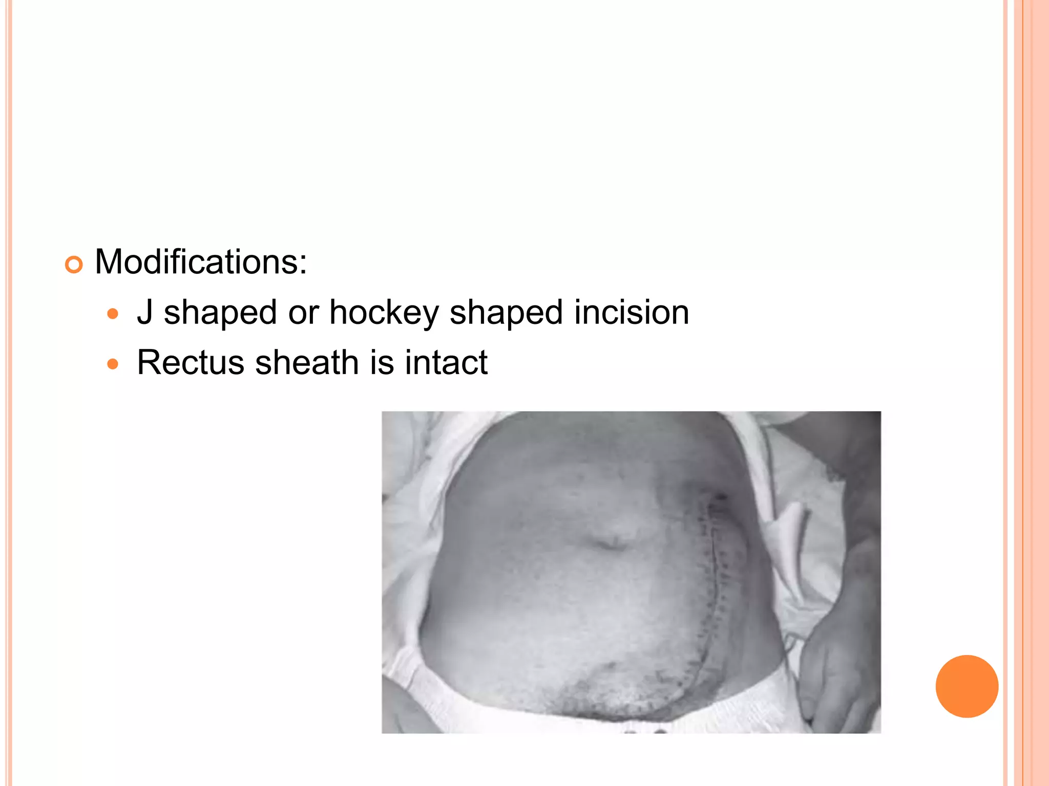 Incisions in Urology.pptx