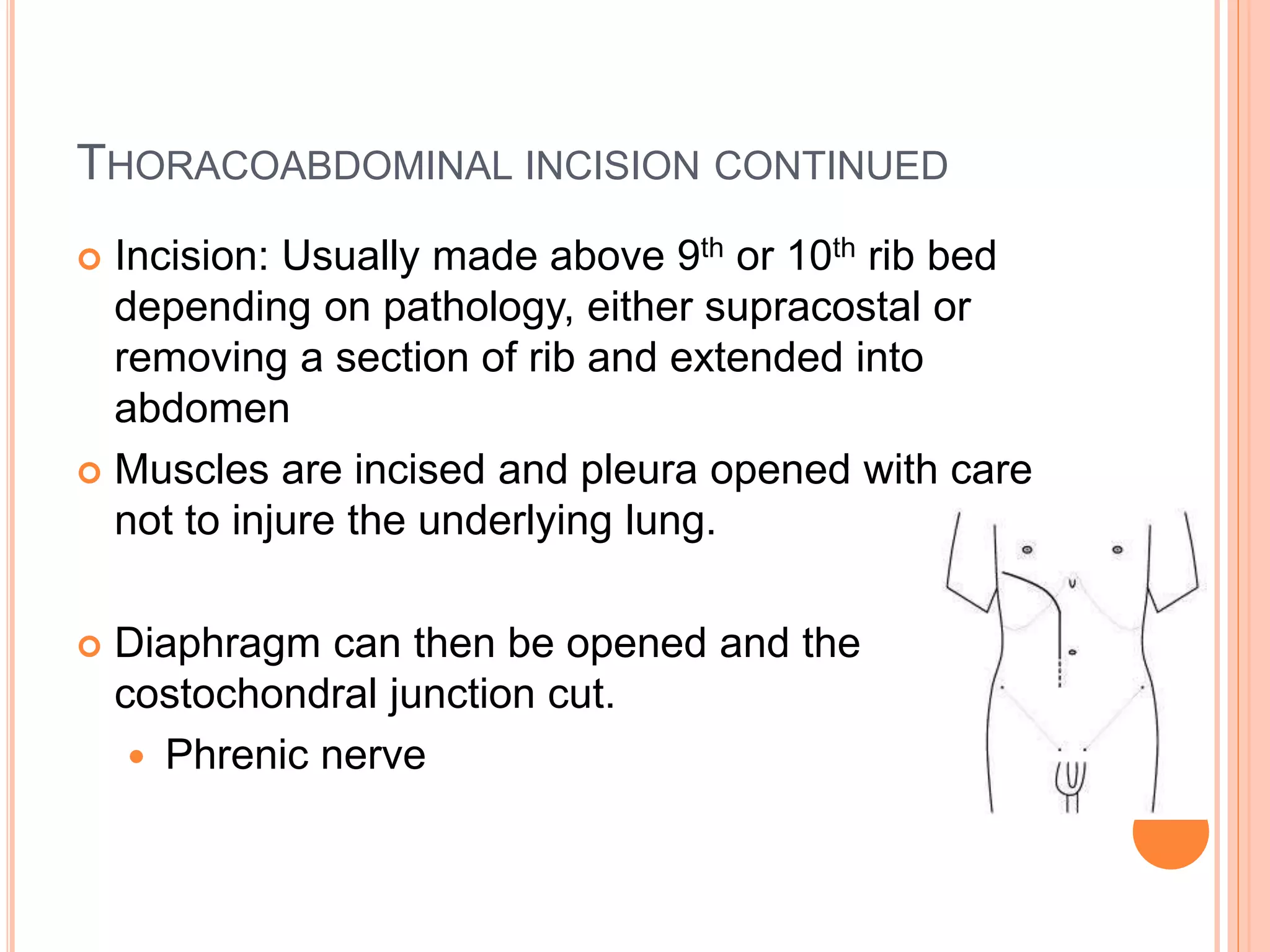 Incisions in Urology.pptx