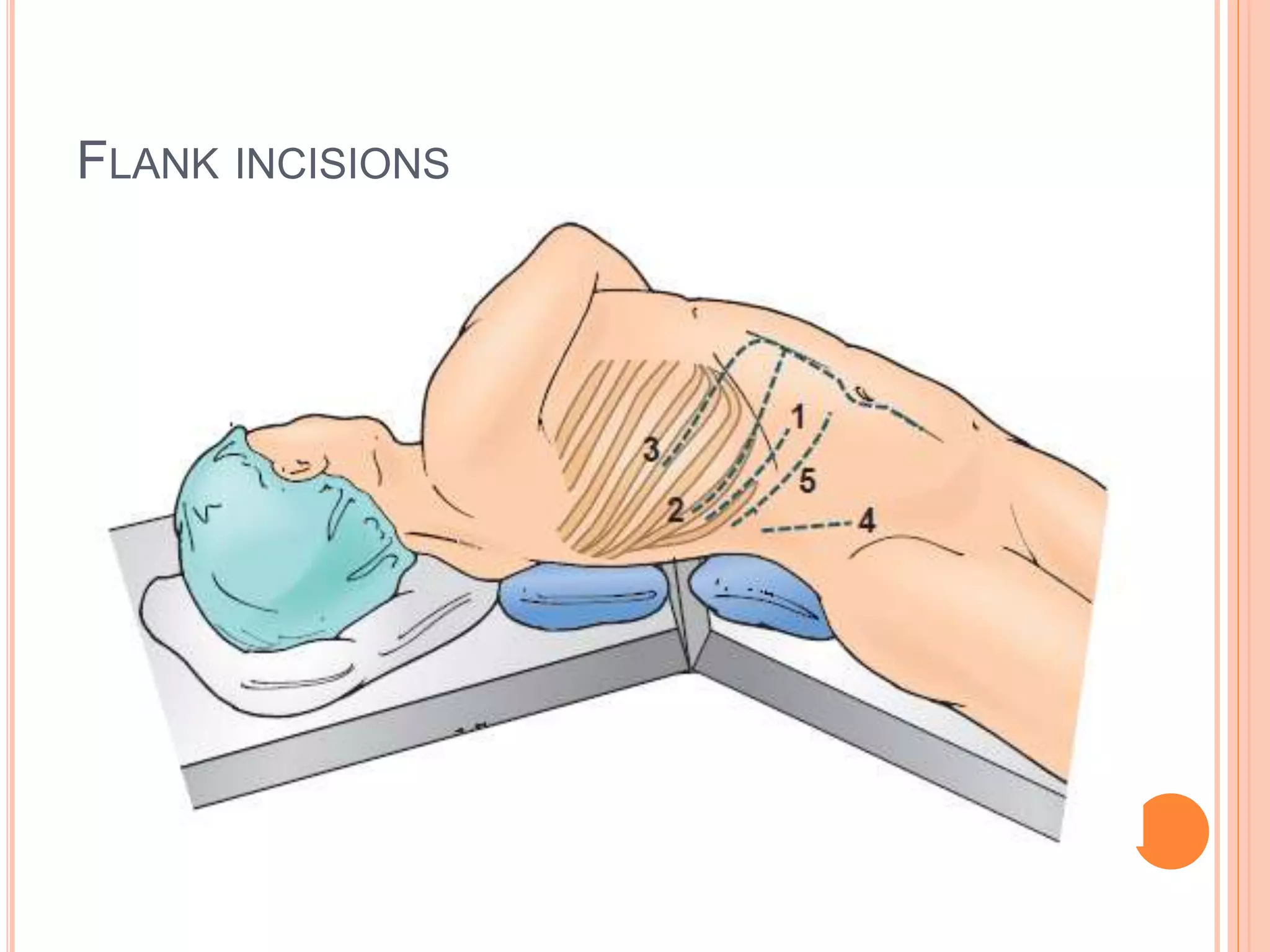 Incisions in Urology.pptx