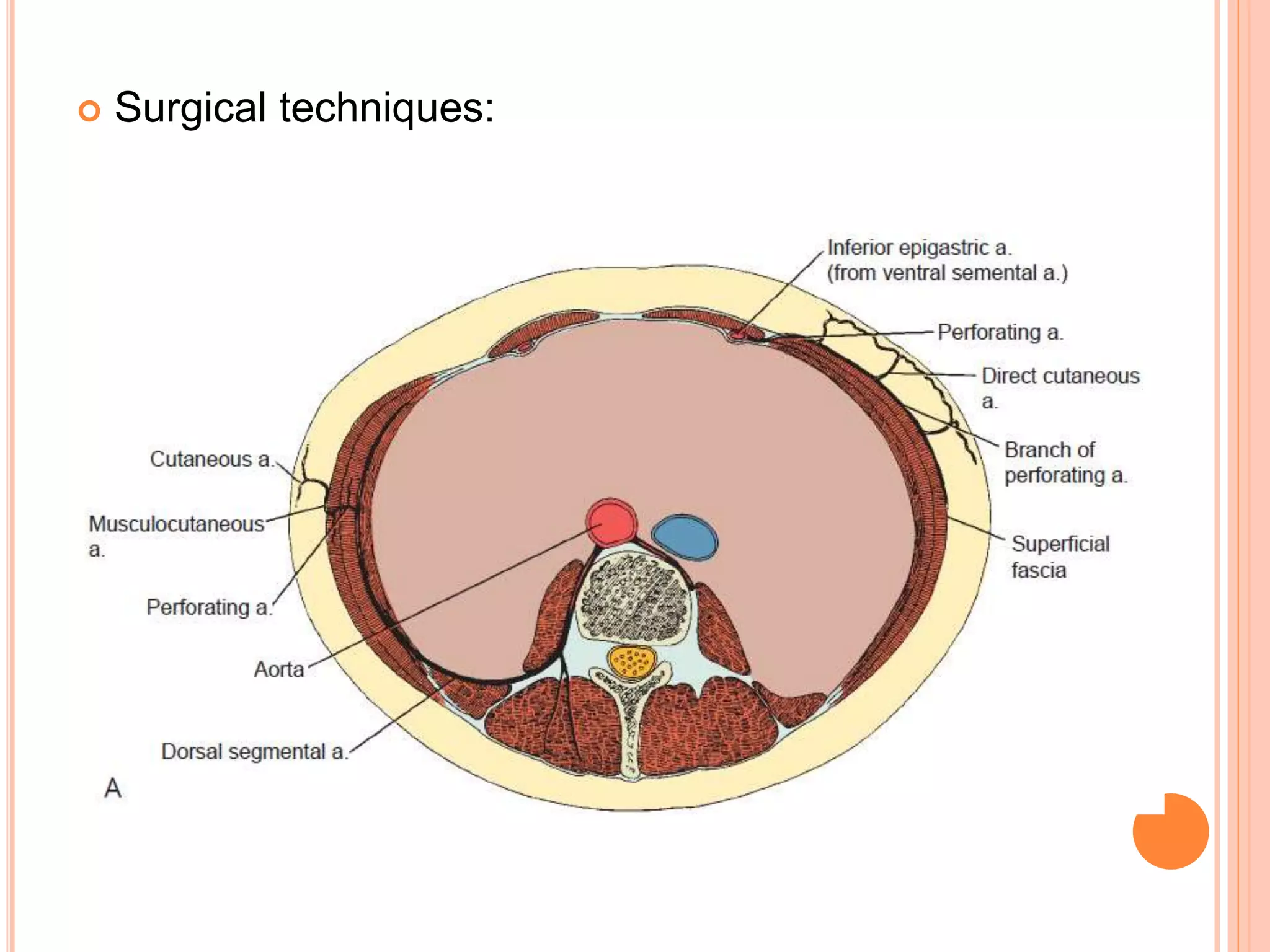 Incisions in Urology.pptx