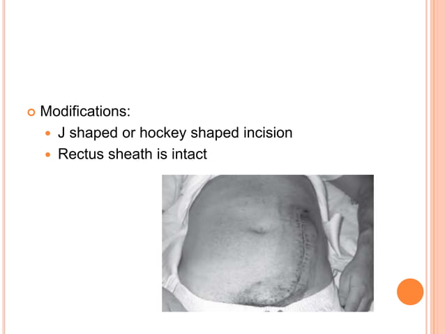Incisions in Urology.pptx