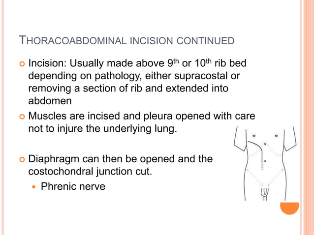 Incisions in Urology.pptx