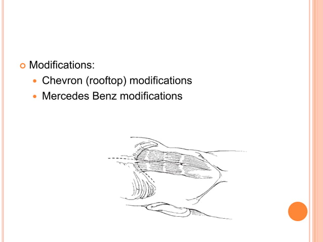 Incisions in Urology.pptx