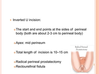 Incisions in Urology.pptx