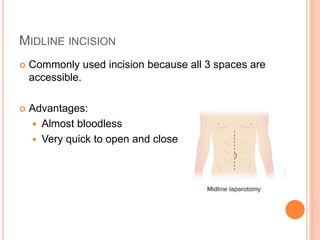 Incisions in Urology.pptx