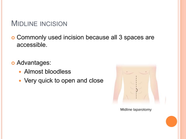 Incisions in Urology.pptx
