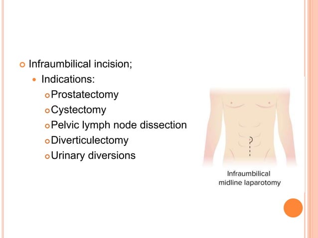 Incisions in Urology.pptx