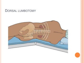 Incisions in Urology.pptx