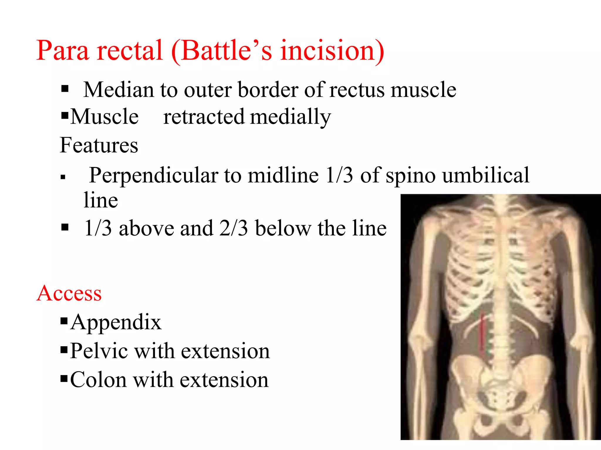 Abdominal incision | PPTX