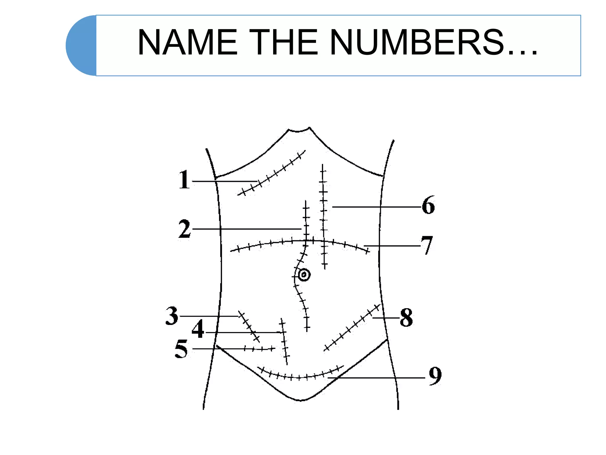Abdominal incision | PPTX