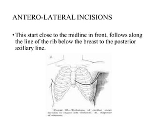 Abdominal incision | PPTX