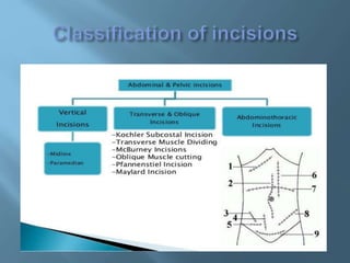 Incisions on abdominal wall’ | PPTX