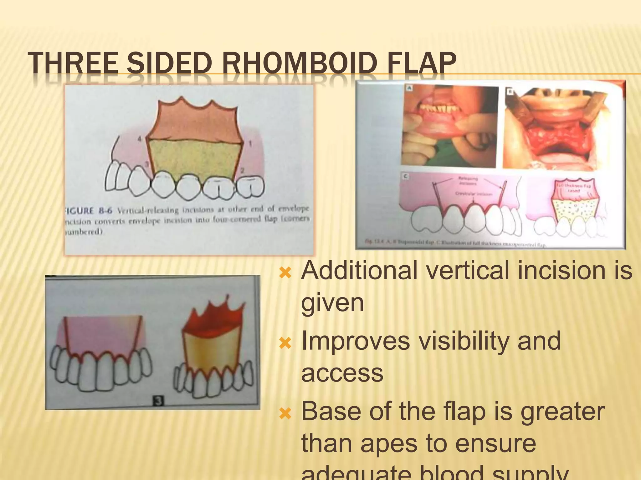 Incision, suture & suture meteri al | PPTX