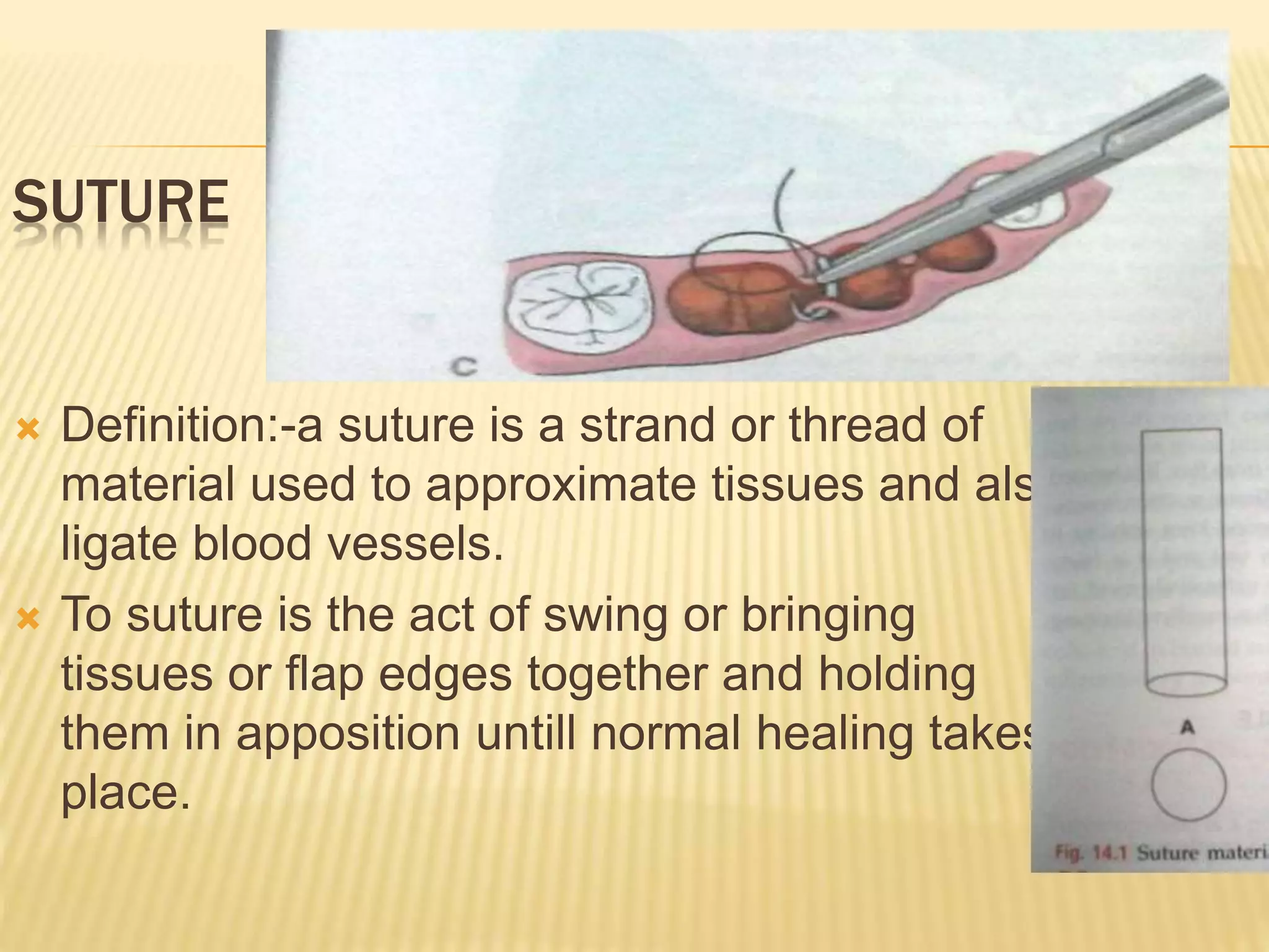 Incision, suture & suture meteri al | PPTX