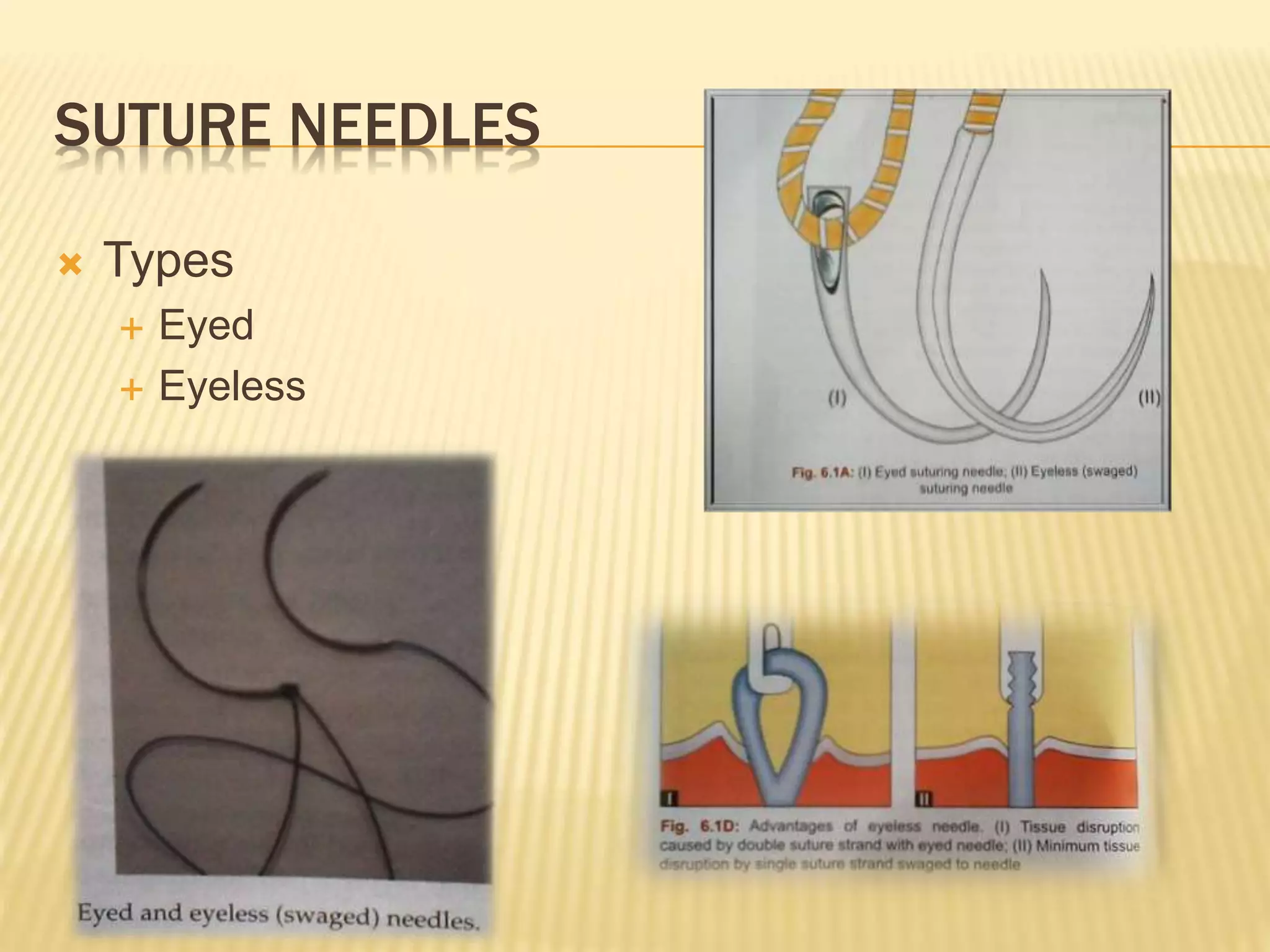 Incision, suture & suture meteri al | PPTX
