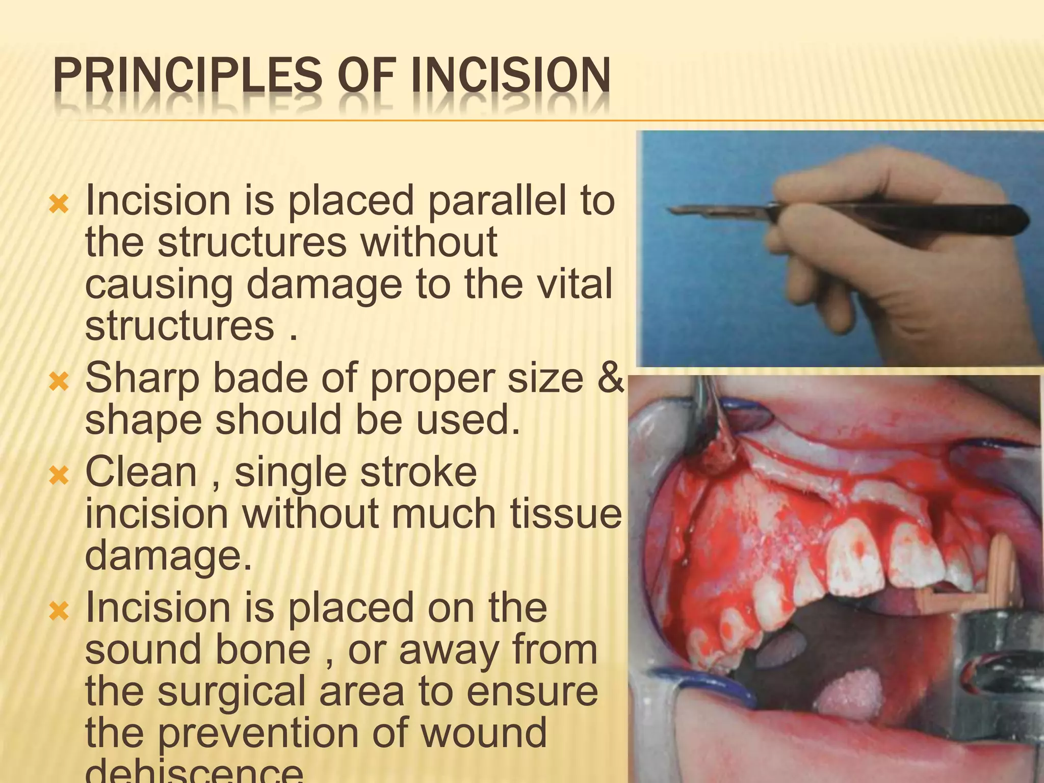 Incision, suture & suture meteri al | PPTX