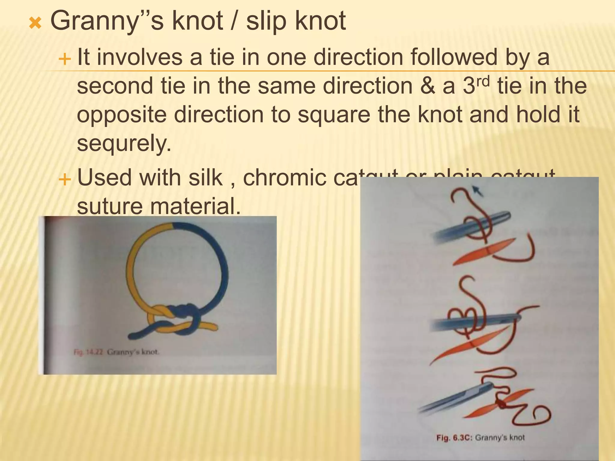 Incision, suture & suture meteri al | PPTX