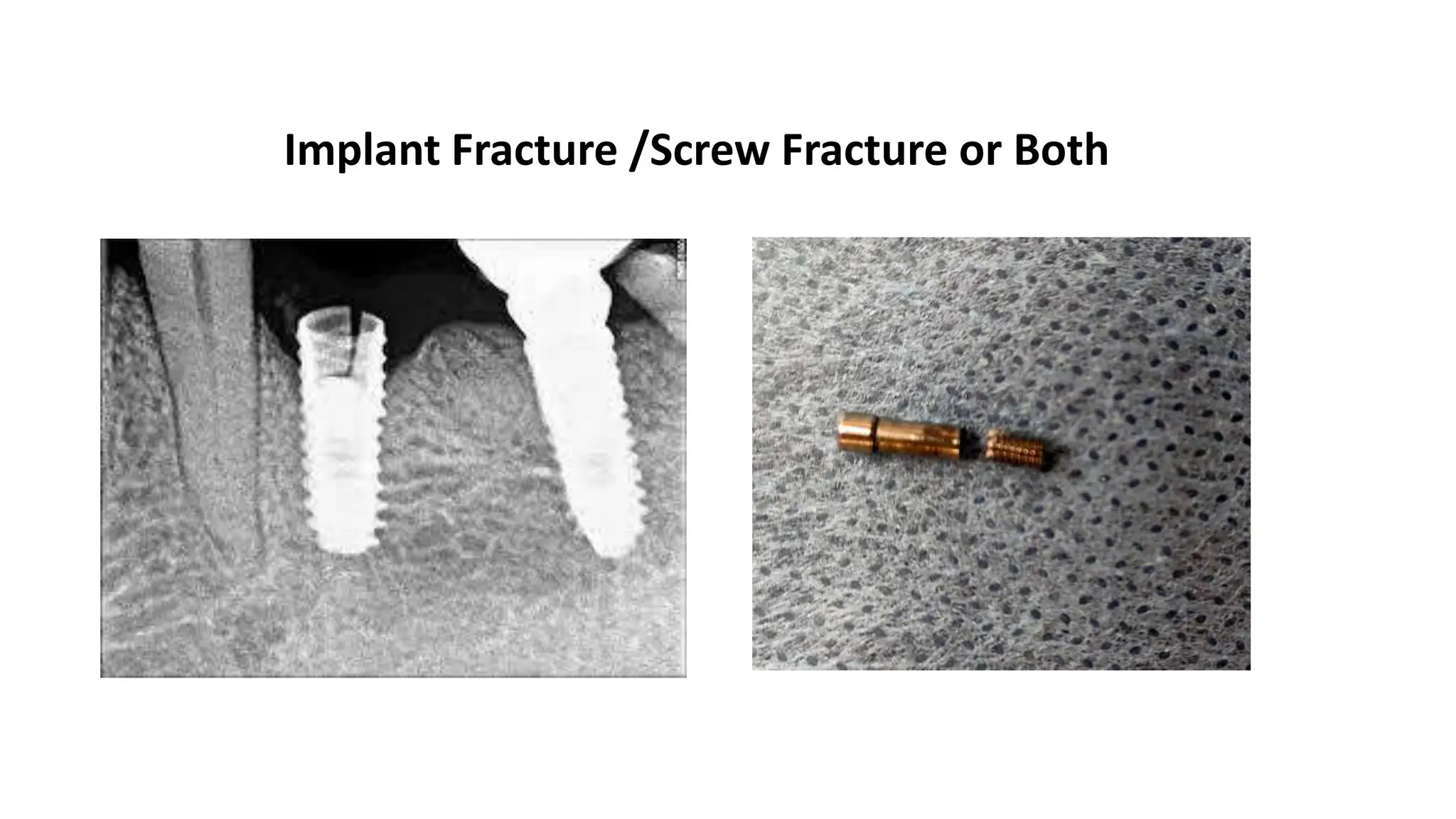 Incision, Suturing Techniques and Complications.pptx