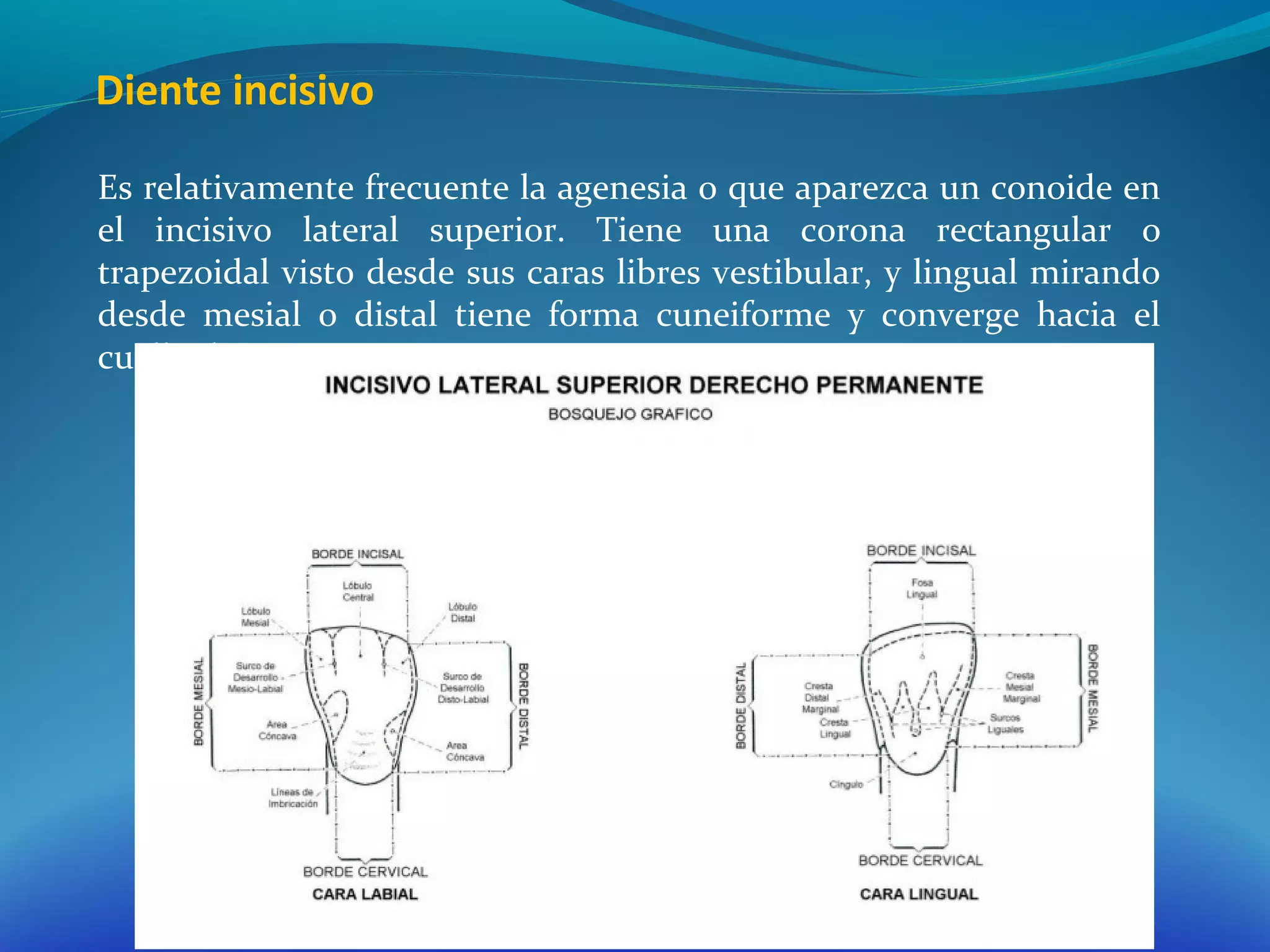 Incisivo lateral superior | PPT