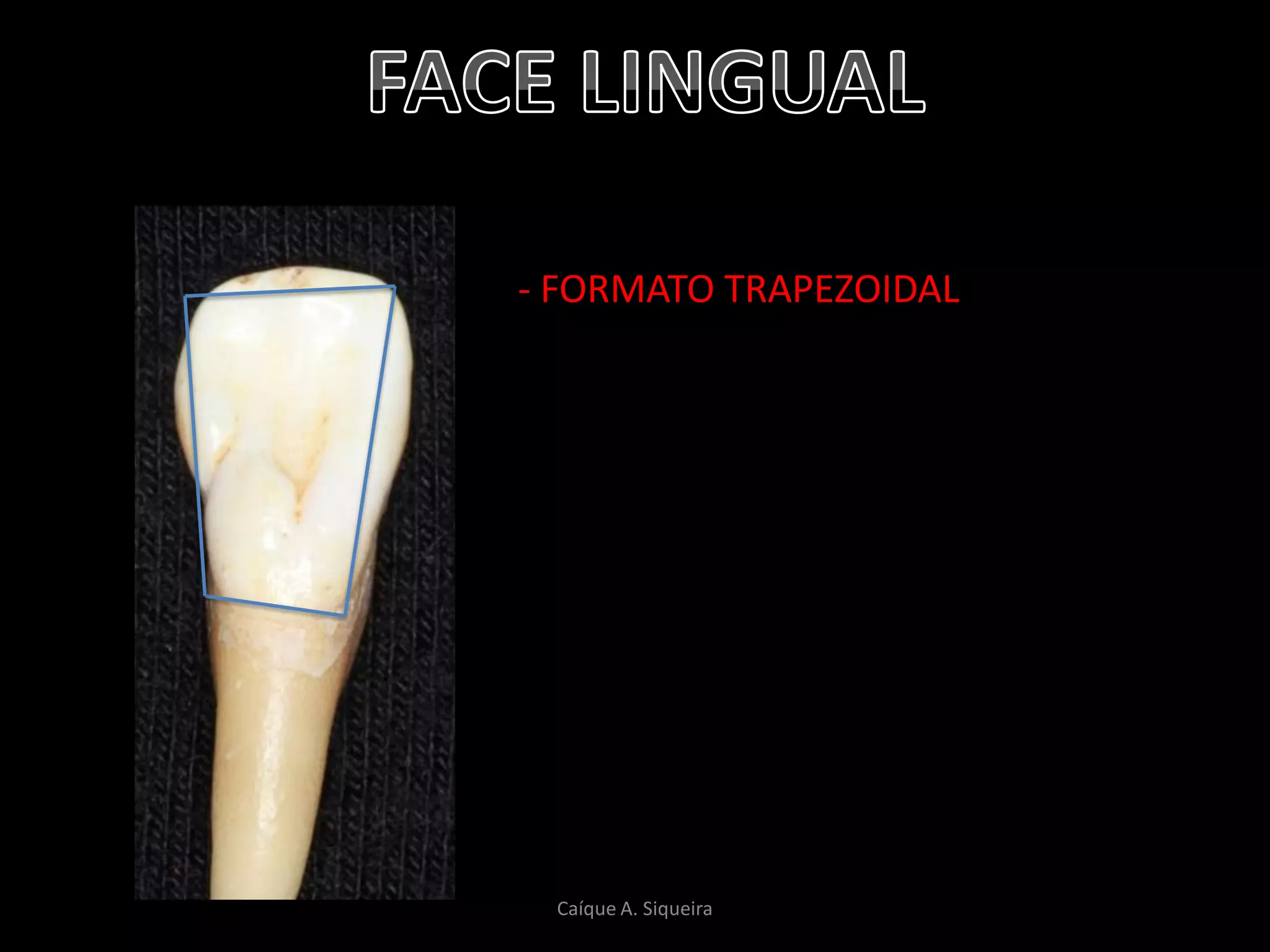 Incisivo lateral anatomia dental | PDF