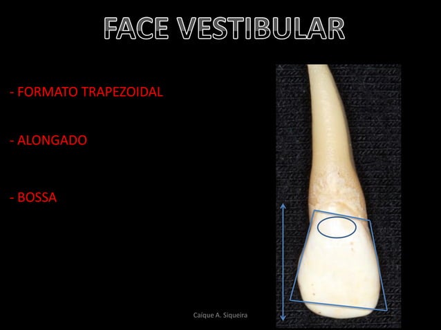 Incisivo lateral anatomia dental | PDF