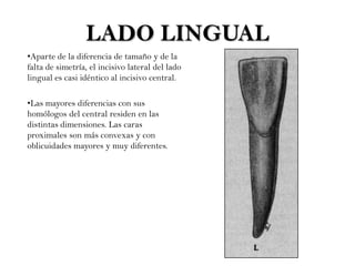 Incisivo lateral inferior | PPTX