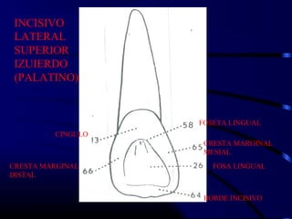 Incisivos permanentes | PPT