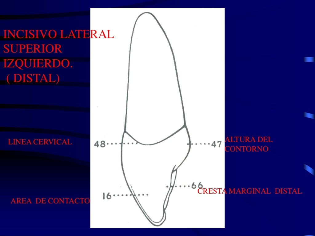 Incisivos Superiores